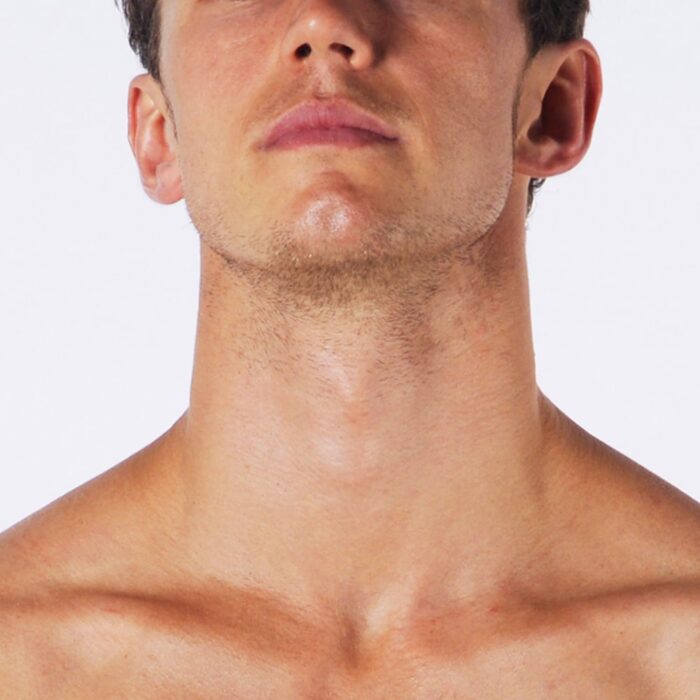 Front of Neck – Rejuvaderm Clinic